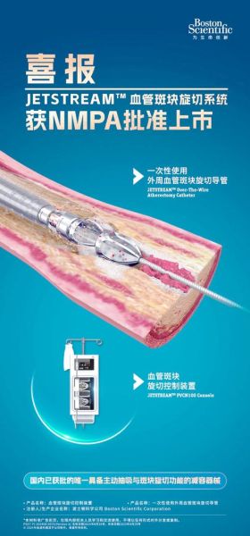 波士顿科学怎么样_波士顿科学有哪些产品-第2张图片-山城妙识