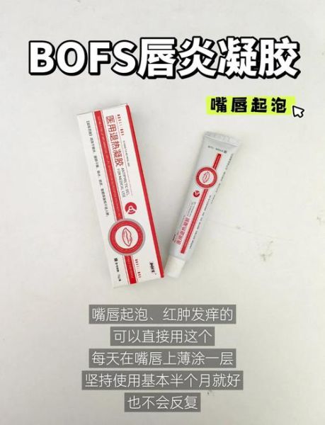 嘴唇起泡用什么药最好_嘴唇起泡擦什么药膏最快好-第1张图片-山城妙识