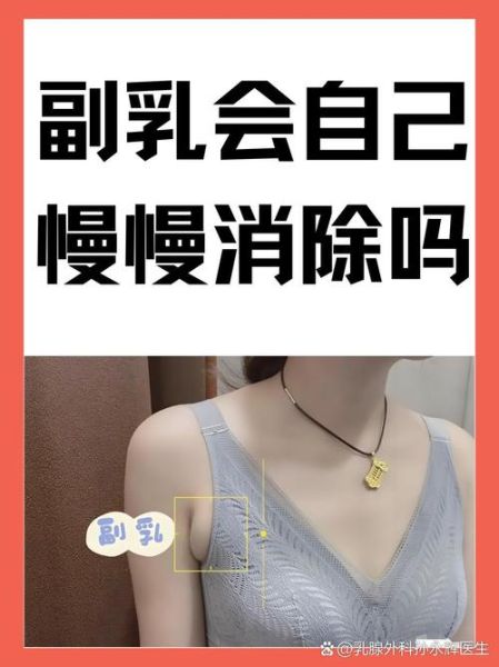 副乳怎么可以消除_副乳消除最有效的方法-第3张图片-山城妙识