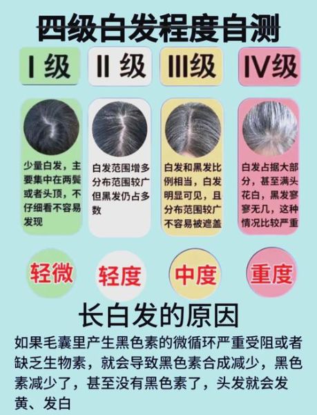 连喝三周白发变黑发_真的有用吗-第1张图片-山城妙识