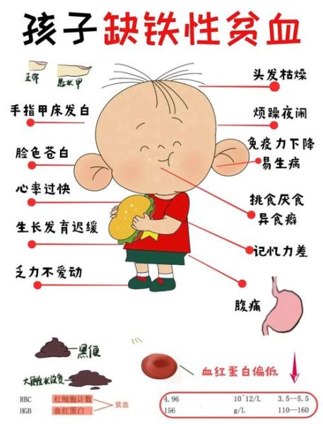 贫血的症状有哪些_如何判断自己是否贫血-第2张图片-山城妙识