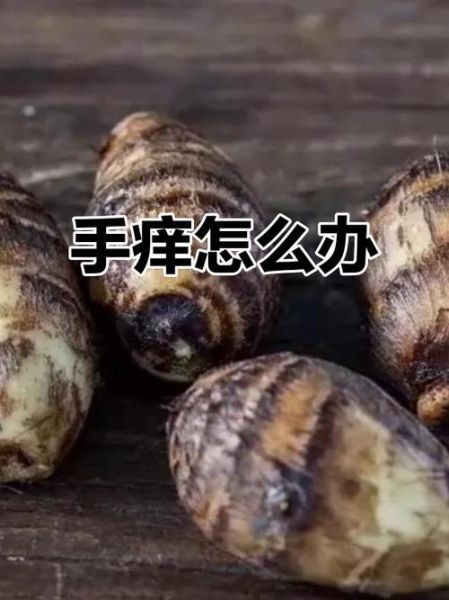 芋头手痒怎么办_最快止痒方法-第3张图片-山城妙识