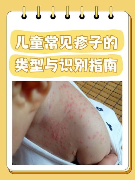 皮肤病图片大全_如何快速识别常见类型-第1张图片-山城妙识