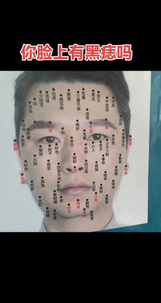 面相痣的位置图解_面相痣代表什么-第1张图片-山城妙识