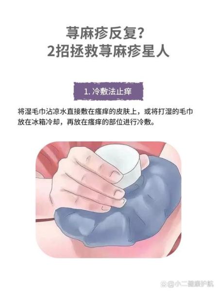 荨麻疹怎么快速止痒_荨麻疹止痒最快的方法-第1张图片-山城妙识