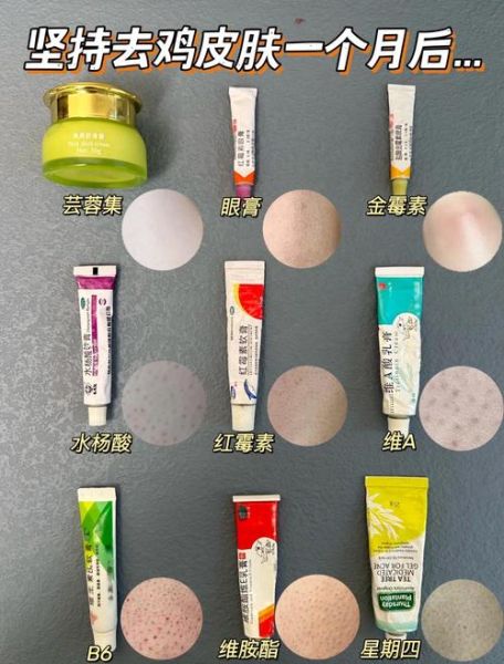 鸡皮肤用什么药膏最好_鸡皮肤怎么去除最有效-第3张图片-山城妙识