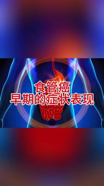 食道癌的早期症状有哪些_食道癌前兆是什么-第3张图片-山城妙识