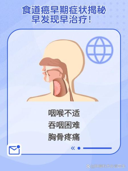 食道癌的早期症状有哪些_食道癌前兆是什么-第1张图片-山城妙识