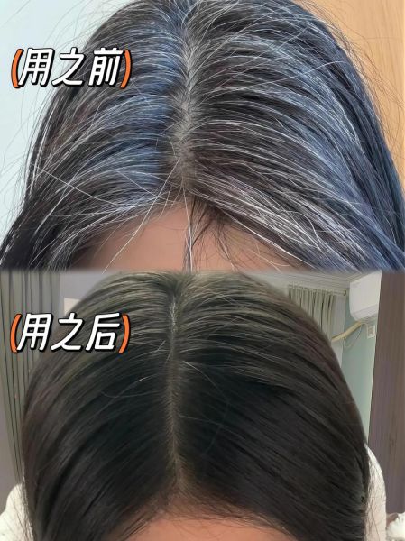 治白头发最有效的方法_白头发怎么调理变黑-第2张图片-山城妙识