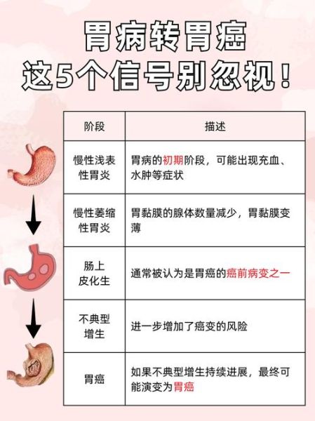 胃炎严重吗_胃炎会不会癌变-第1张图片-山城妙识 胃炎严重吗_胃炎会不会癌变-第1张图片-山城妙识