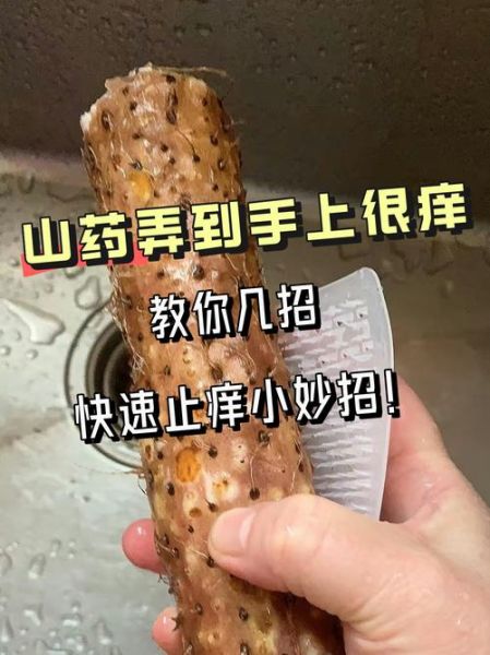 铁棍山药痒怎么快速止痒_手痒怎么办-第1张图片-山城妙识