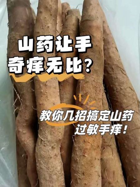 铁棍山药痒怎么快速止痒_手痒怎么办-第2张图片-山城妙识