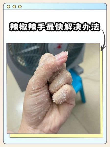 辣椒辣手怎么快速止痛_切辣椒后手很辣怎么办-第1张图片-山城妙识