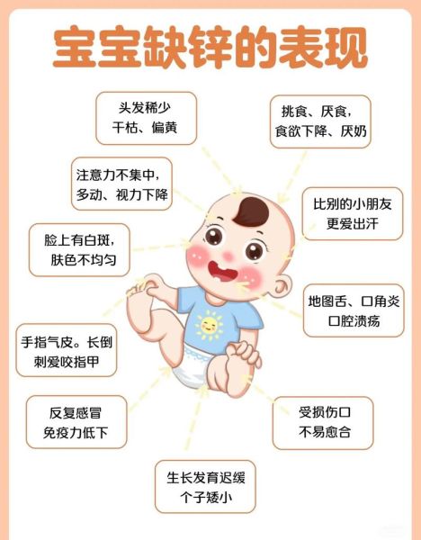 儿童缺锌有哪些症状_如何判断孩子是否缺锌-第2张图片-山城妙识