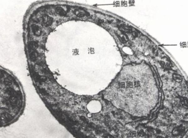 酵母菌是真核还是原核_酵母菌细胞结构特点-第3张图片-山城妙识