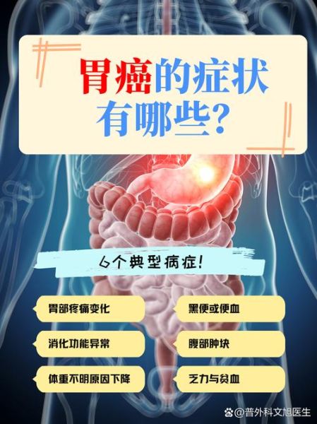 饭后两个症状胃癌来了_是真是假-第2张图片-山城妙识 饭后两个症状胃癌来了_是真是假-第2张图片-山城妙识