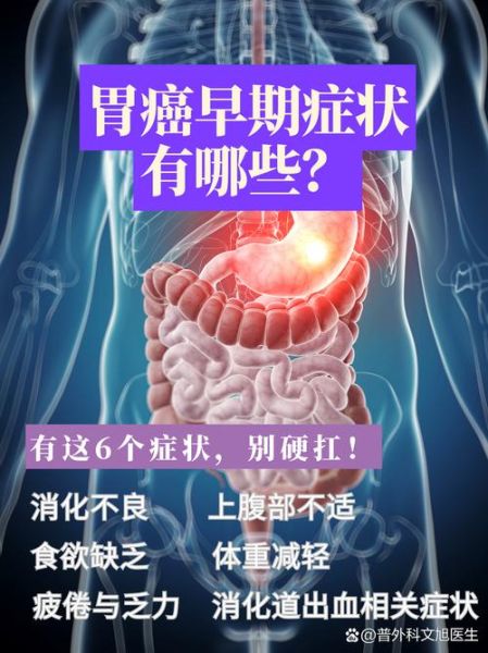 饭后两个症状胃癌来了_是真是假-第1张图片-山城妙识 饭后两个症状胃癌来了_是真是假-第1张图片-山城妙识