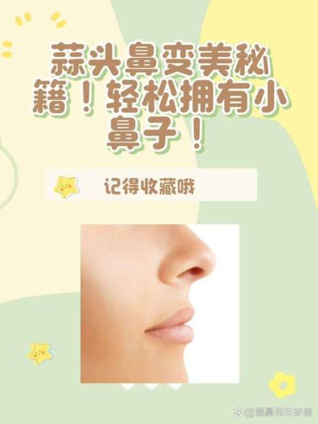 蒜头鼻怎么改善_蒜头鼻怎么自然变小-第1张图片-山城妙识 蒜头鼻怎么改善_蒜头鼻怎么自然变小-第1张图片-山城妙识