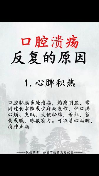 口腔溃疡反复发作是什么原因_怎么根治-第2张图片-山城妙识