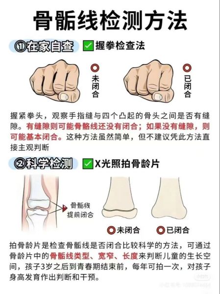 骨骺线闭合还能长高吗_骨骺线闭合增高9厘米是真的吗-第3张图片-山城妙识