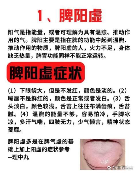 男性脾虚的症状有哪些_脾虚怎么调理-第2张图片-山城妙识