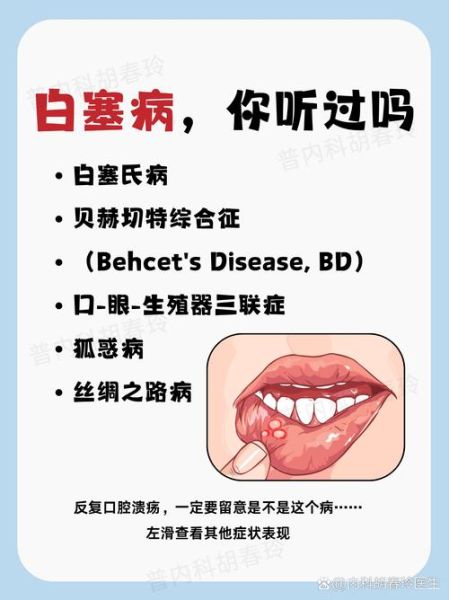 溃疡中间白色是啥东西_口腔溃疡白膜多久脱落-第3张图片-山城妙识