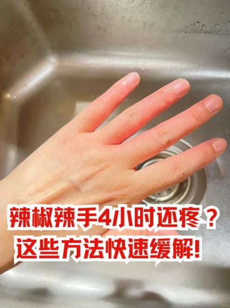辣椒辣手用冰敷会更严重吗_辣椒辣手最快缓解方法-第1张图片-山城妙识