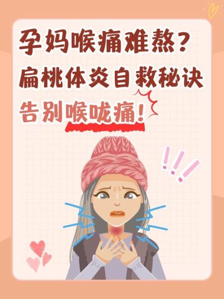 孕妇扁桃体发炎怎么办_孕妇扁桃体发炎小妙招-第2张图片-山城妙识