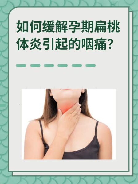 孕妇扁桃体发炎怎么办_孕妇扁桃体发炎小妙招-第3张图片-山城妙识