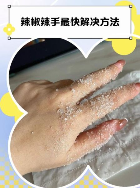 辣椒辣手痛到想死怎么办_辣椒辣手最快缓解方法-第2张图片-山城妙识