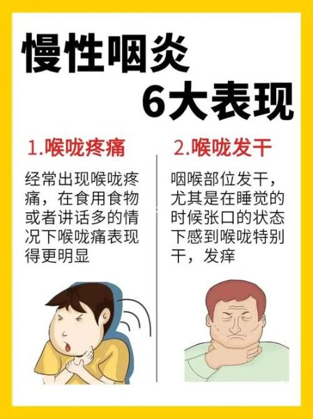 慢性咽炎能自愈吗_慢性咽炎多久能好-第1张图片-山城妙识