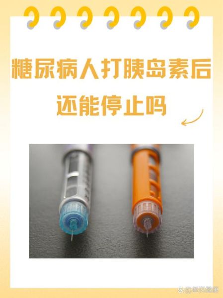 胰岛素一旦打了就终身打吗_停用条件有哪些-第1张图片-山城妙识 胰岛素一旦打了就终身打吗_停用条件有哪些-第1张图片-山城妙识