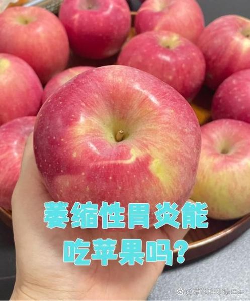腹泻吃什么水果_腹泻能吃苹果吗-第3张图片-山城妙识