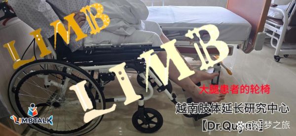 增高手术后悔了怎么办_增高手术失败怎么补救-第3张图片-山城妙识