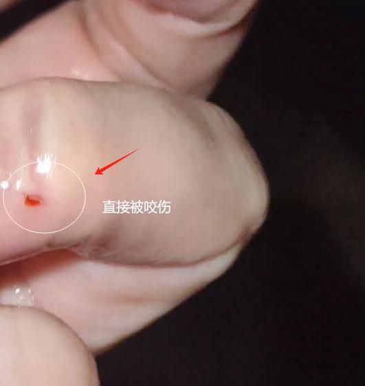 黄鳝会咬人吗_被黄鳝咬了怎么办-第1张图片-山城妙识 黄鳝会咬人吗_被黄鳝咬了怎么办-第1张图片-山城妙识