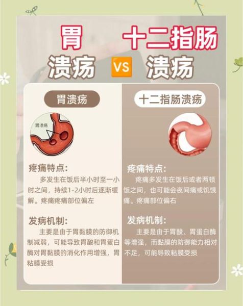 胃糜烂和胃溃疡哪个严重_区别与后果-第1张图片-山城妙识