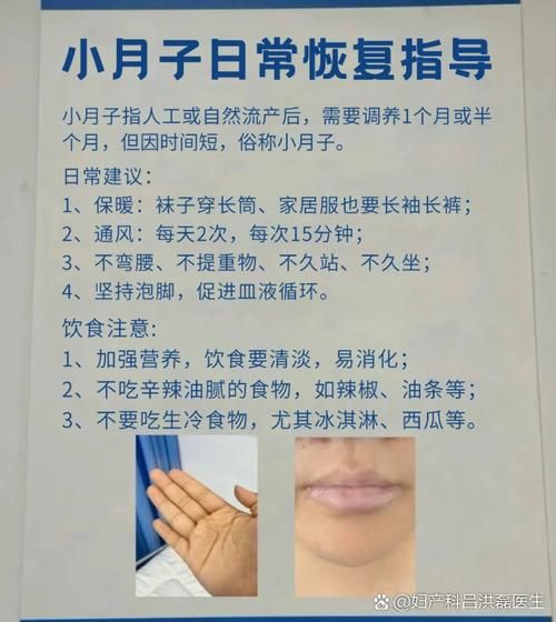 小月子流产休息多少天_流产后多久能上班-第1张图片-山城妙识