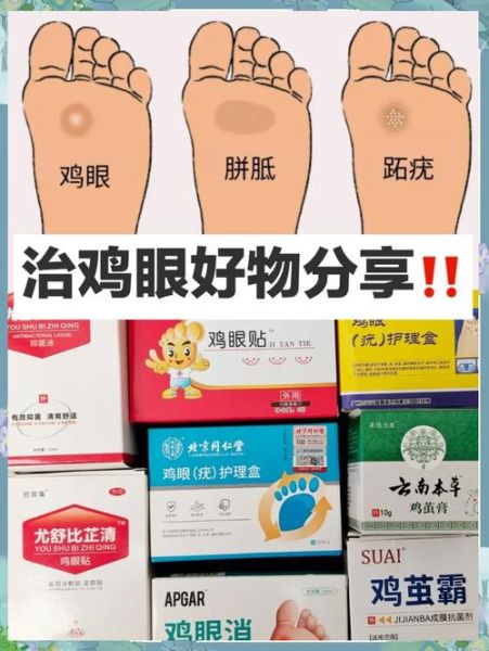 鸡眼怎么根治_鸡眼贴多久能好-第1张图片-山城妙识