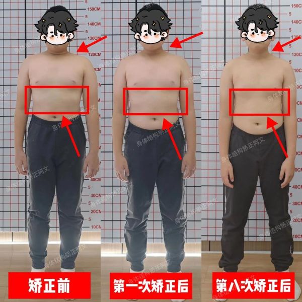 儿童平躺肋骨突出正常吗_如何判断肋骨外翻-第3张图片-山城妙识