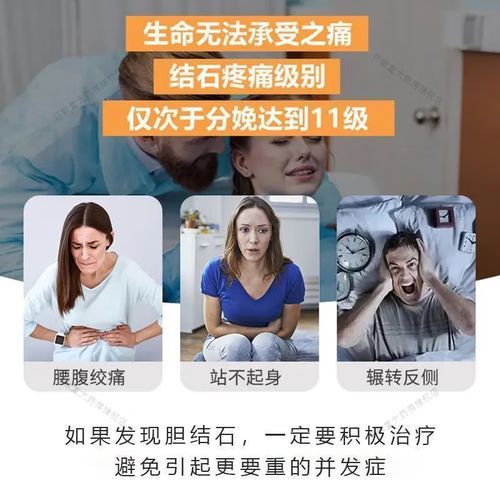 胆结石怎么治疗最好_胆结石吃什么药能溶石-第2张图片-山城妙识 胆结石怎么治疗最好_胆结石吃什么药能溶石-第2张图片-山城妙识