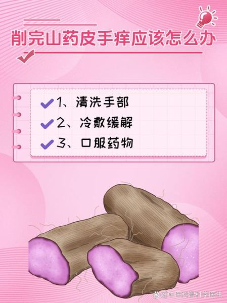 削了山药手痒怎么止痒_山药过敏快速止痒方法-第1张图片-山城妙识 削了山药手痒怎么止痒_山药过敏快速止痒方法-第1张图片-山城妙识