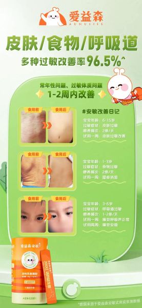 宝宝过敏怎么办最有效_宝宝过敏快速缓解方法-第2张图片-山城妙识 宝宝过敏怎么办最有效_宝宝过敏快速缓解方法-第2张图片-山城妙识