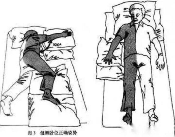 脑梗塞最佳治疗方法_如何快速康复-第3张图片-山城妙识 脑梗塞最佳治疗方法_如何快速康复-第3张图片-山城妙识