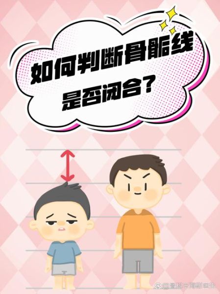 自测骨骼闭合小方法_骨骺线是否闭合怎么判断-第1张图片-山城妙识