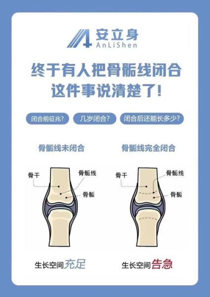 自测骨骼闭合小方法_骨骺线是否闭合怎么判断-第3张图片-山城妙识