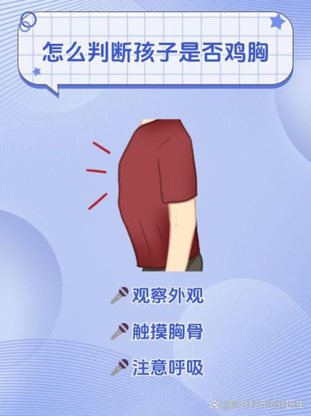 鸡胸和正常人胸部对比图_鸡胸矫正方法有哪些-第1张图片-山城妙识