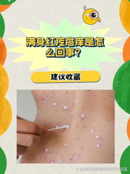 身上起红疙瘩越挠越痒_怎么办-第2张图片-山城妙识 身上起红疙瘩越挠越痒_怎么办-第2张图片-山城妙识