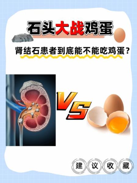肾结石能吃鸡蛋吗_肾结石一天可以吃几个鸡蛋-第2张图片-山城妙识 肾结石能吃鸡蛋吗_肾结石一天可以吃几个鸡蛋-第2张图片-山城妙识