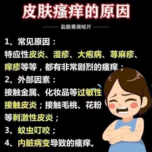 过敏吃什么药_过敏药怎么选-第3张图片-山城妙识 过敏吃什么药_过敏药怎么选-第3张图片-山城妙识