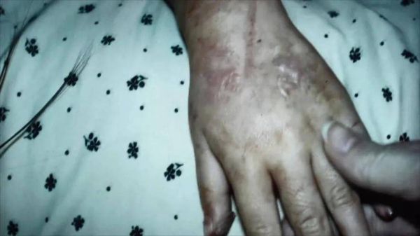 莲蓬乳图片_为什么会让人恐惧-第3张图片-山城妙识 莲蓬乳图片_为什么会让人恐惧-第3张图片-山城妙识